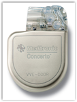 Study Claims Medtronic Builds a Better Cardiac Reset Device–Higher ...